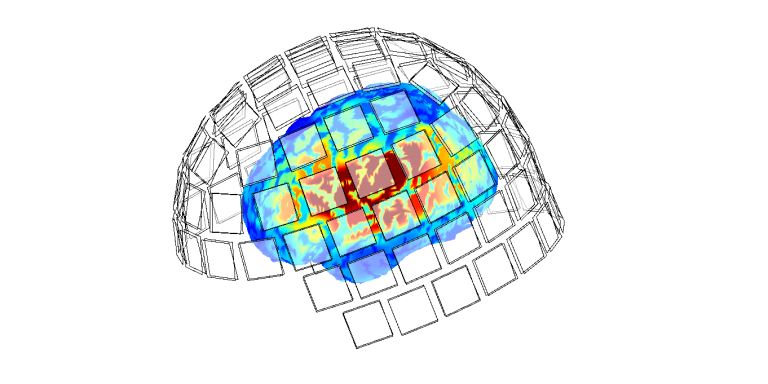 Sensor Array – MEG NOTE