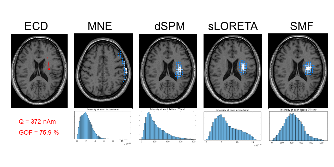 Non-adaptive Beamformer (dSPM, sLORETA, SMF) – MEG NOTE